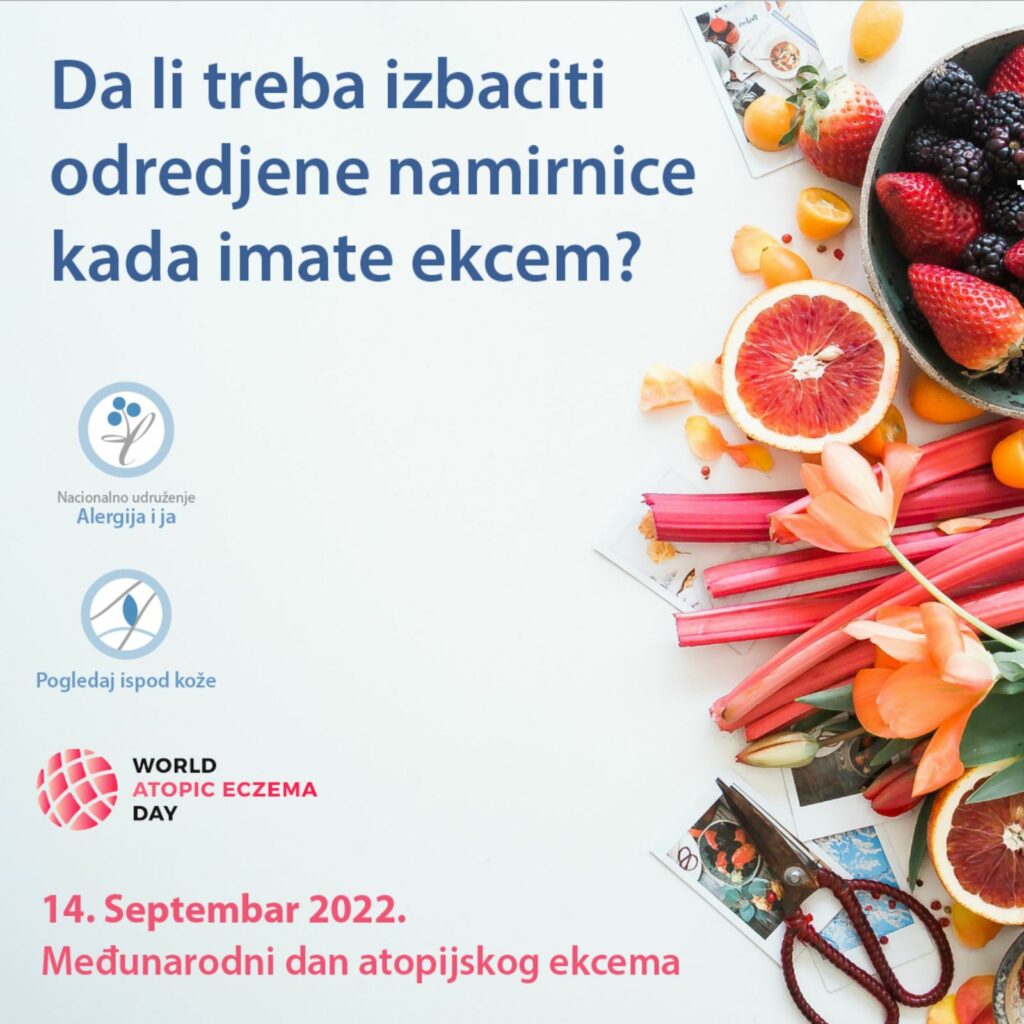 Da li treba izbaciti određene namirnice kada imate ekcem? - Alergija i ja
